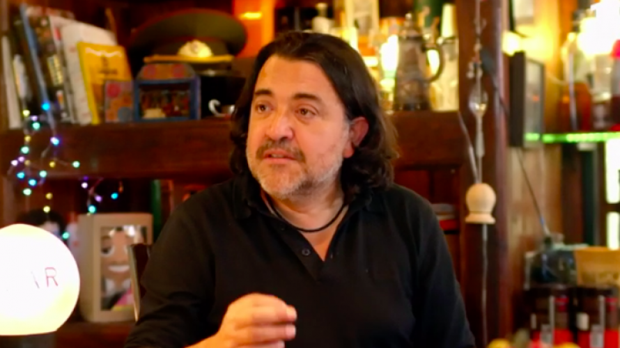 Leo Caprile habló sobre su experiencia con la alopecia