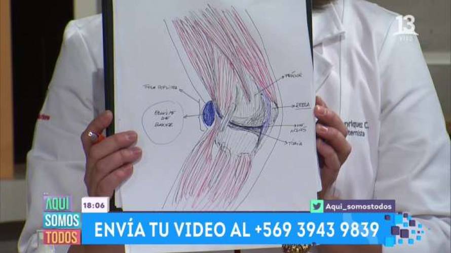 Tengo el quiste de Baker roto ¿Qué puedo hacer?