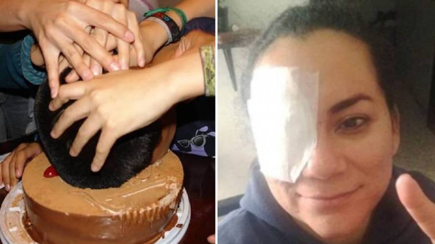 ”Estúpida tendencia”: mujer casi pierde el ojo por tortazo de ...